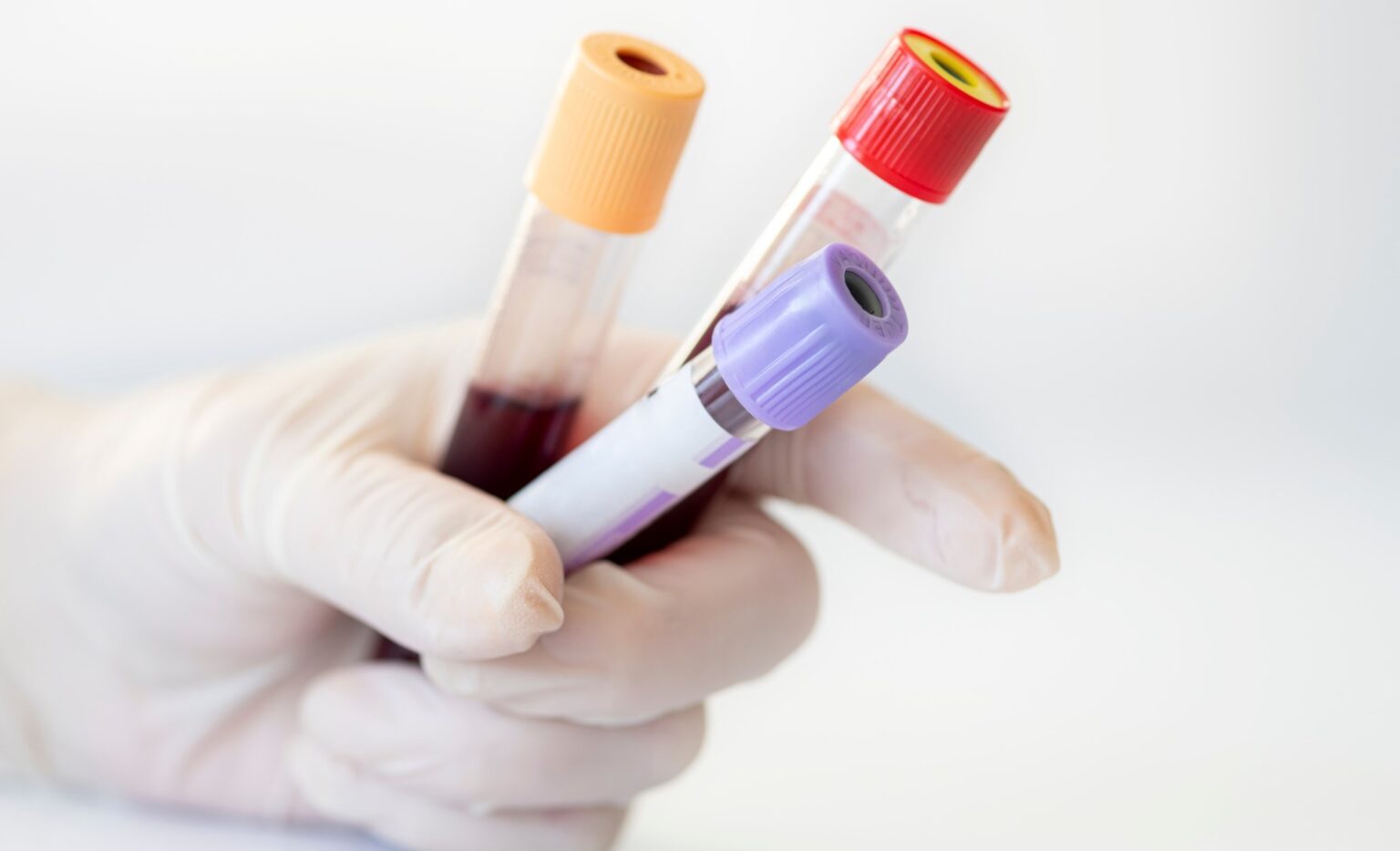 What Is OPIM? Understanding OPIMs and How to Properly Handle Them | ASMAI